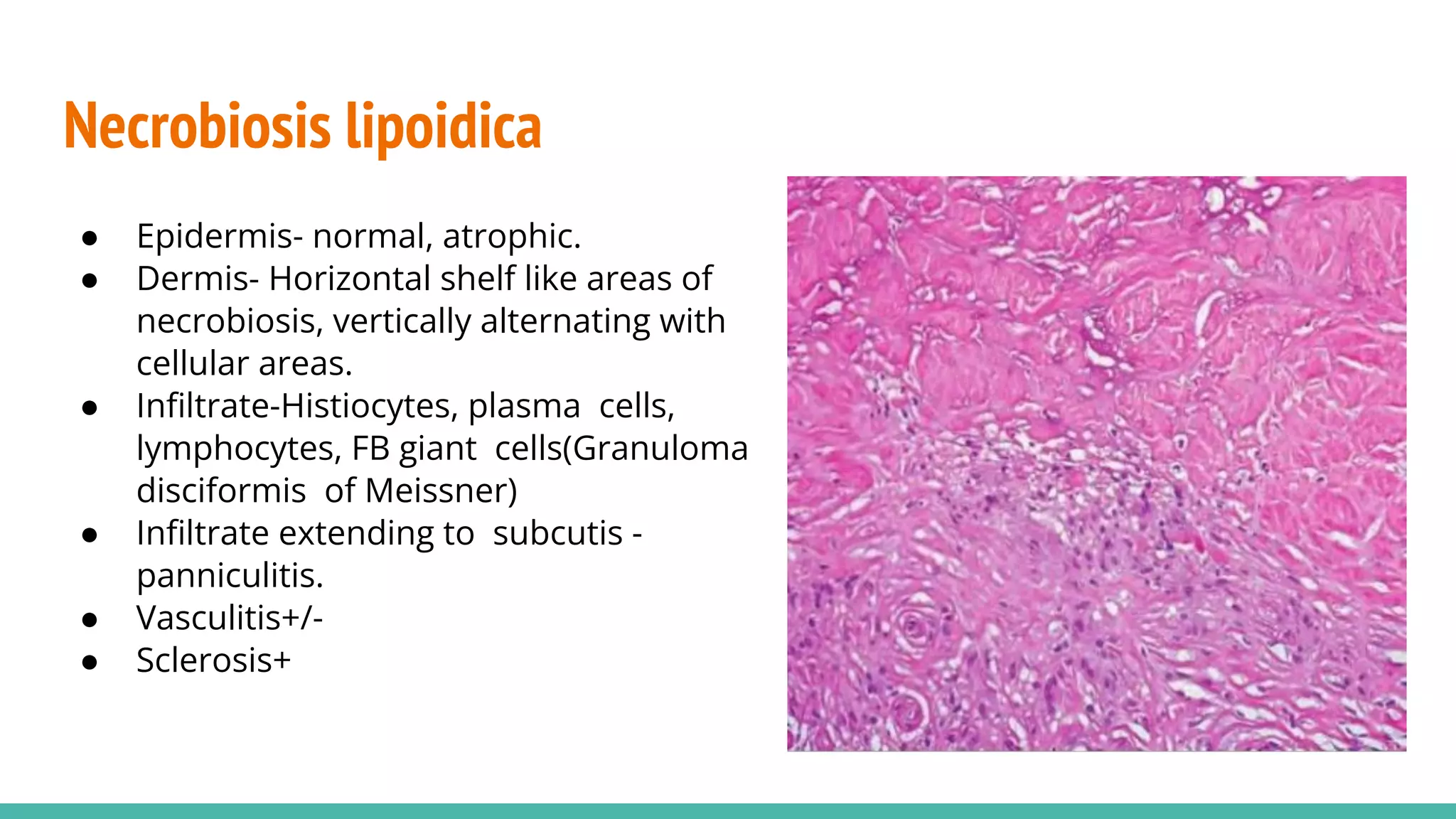 Granulomas in Dermatology.pdf