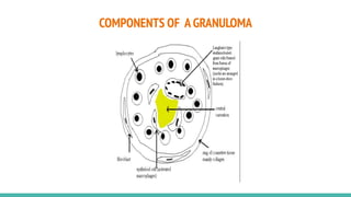 Granulomas in Dermatology.pdf