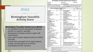 Granulomatosis polyangitis GPA | PPTX