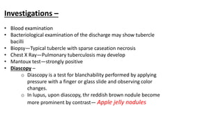 Granulomatous diseases of nose | PPT
