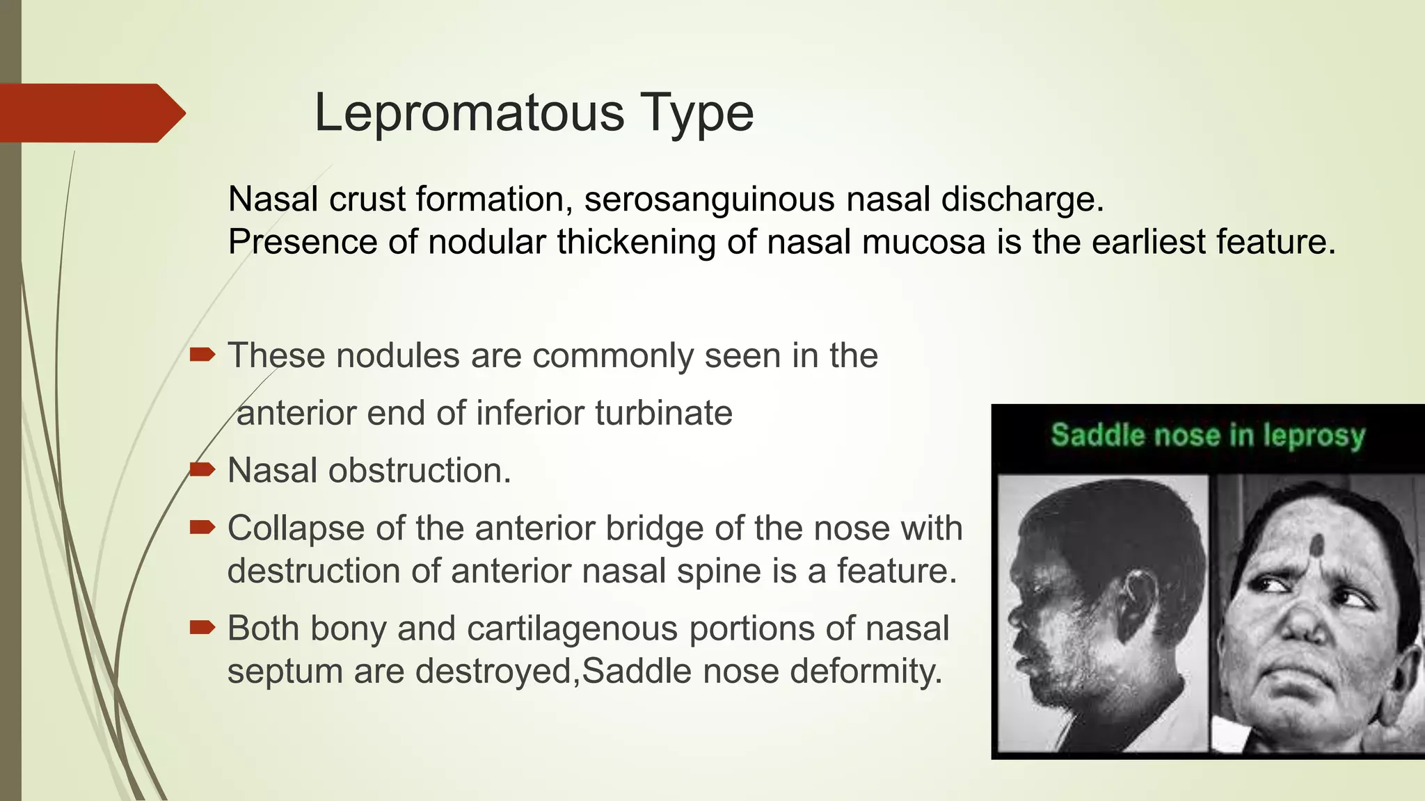 Granulomatous diseases of nose | PPTX