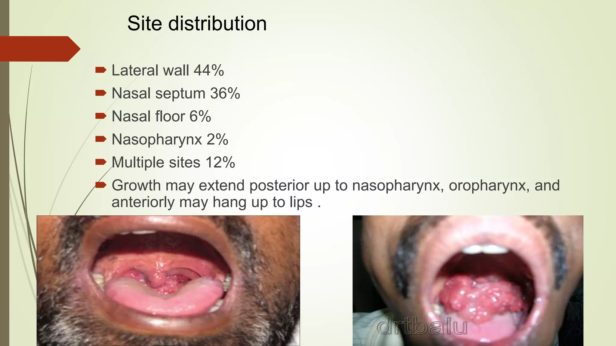 granulomatousdiseasesofnose-190901125747 (1).pdf