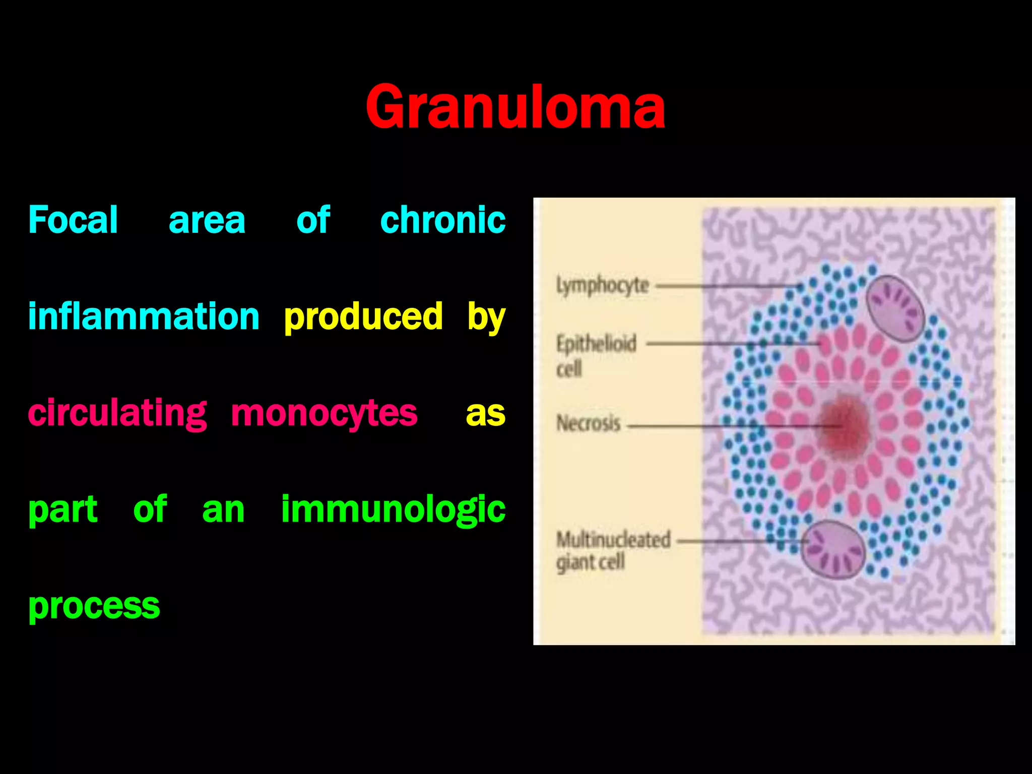 Granulomatous diseases of nose | PPT