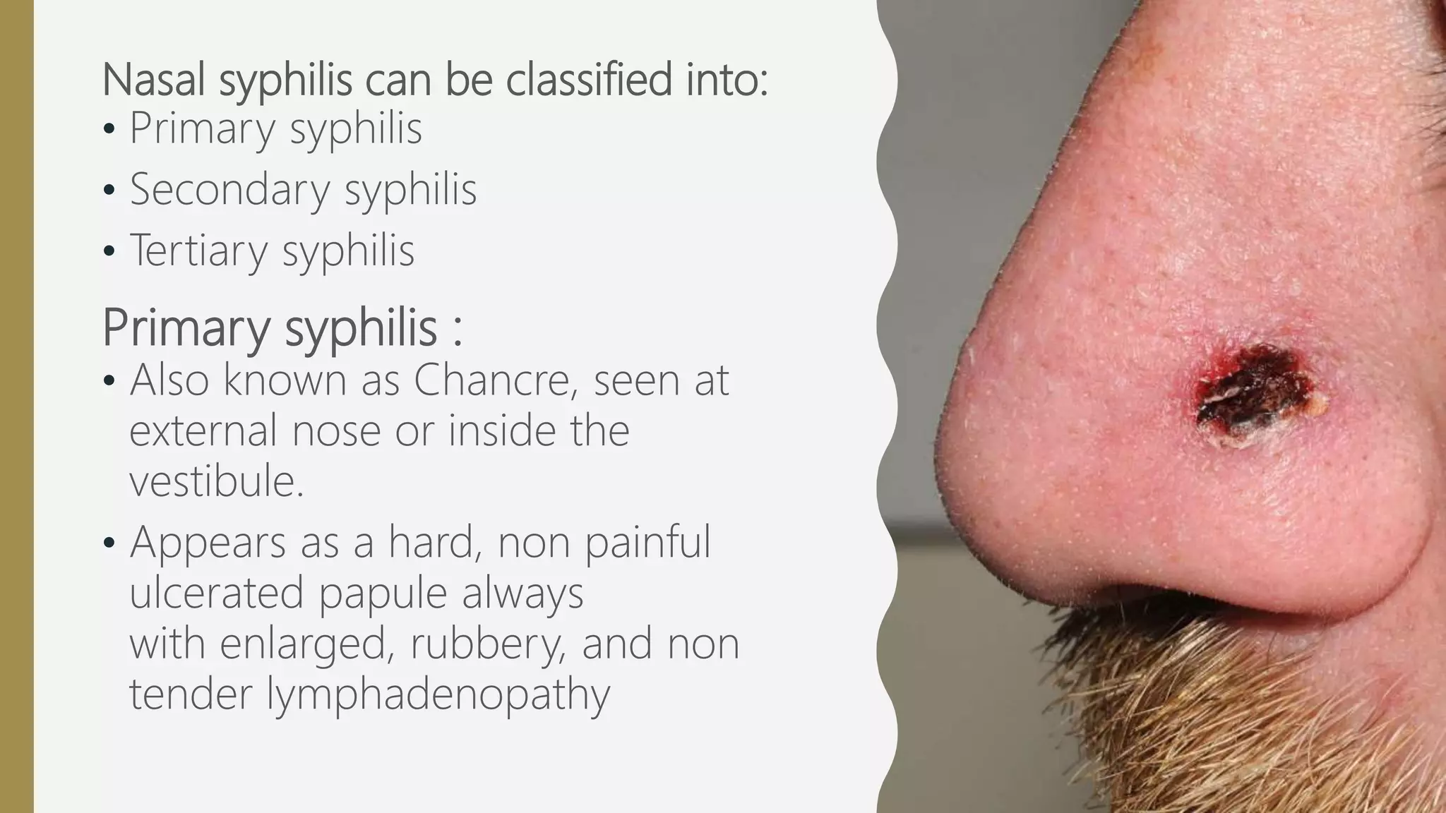 Granulomatous Diseases Of Nose And Pns Pptx