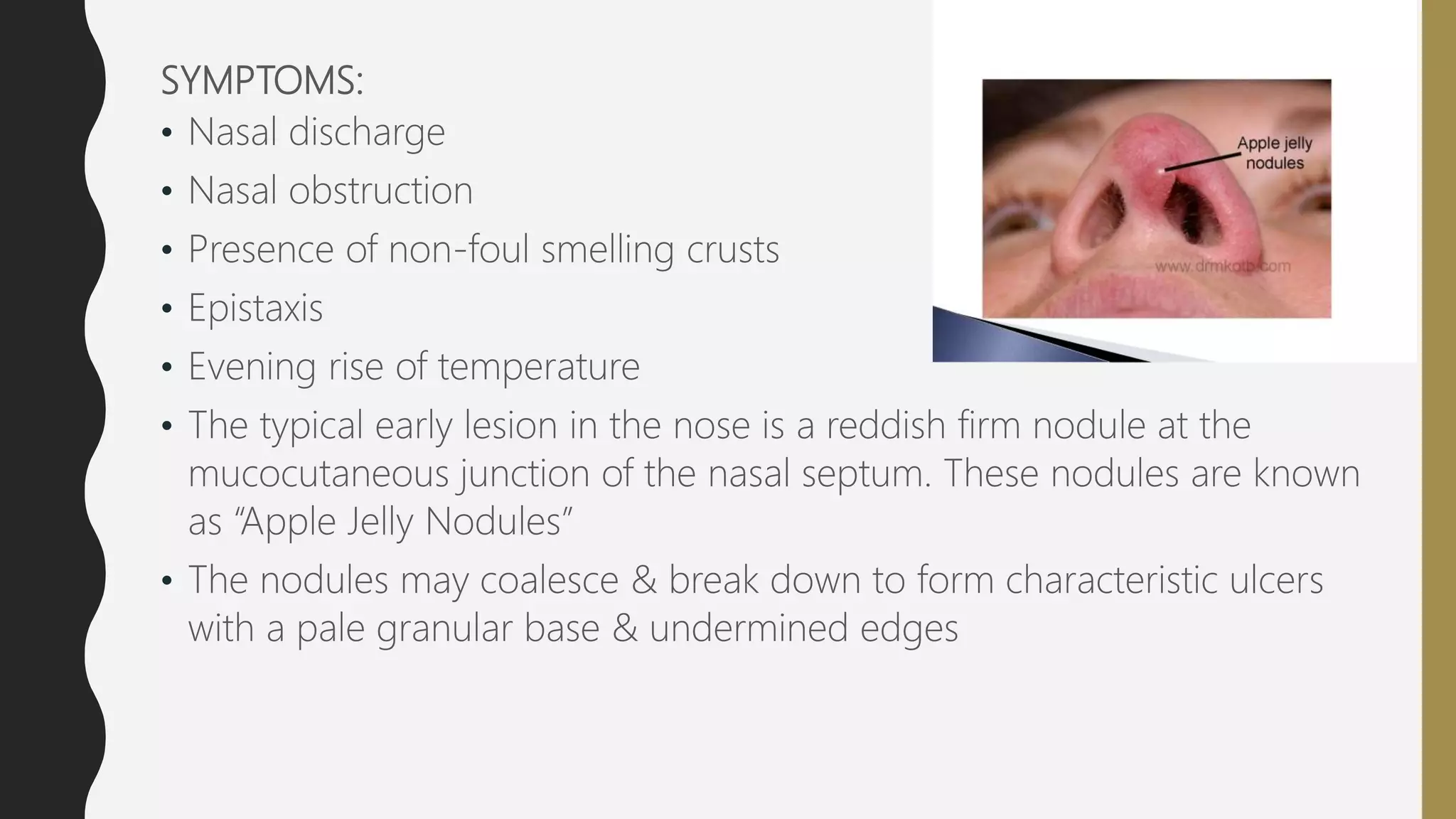 Granulomatous diseases of nose and pns | PPTX