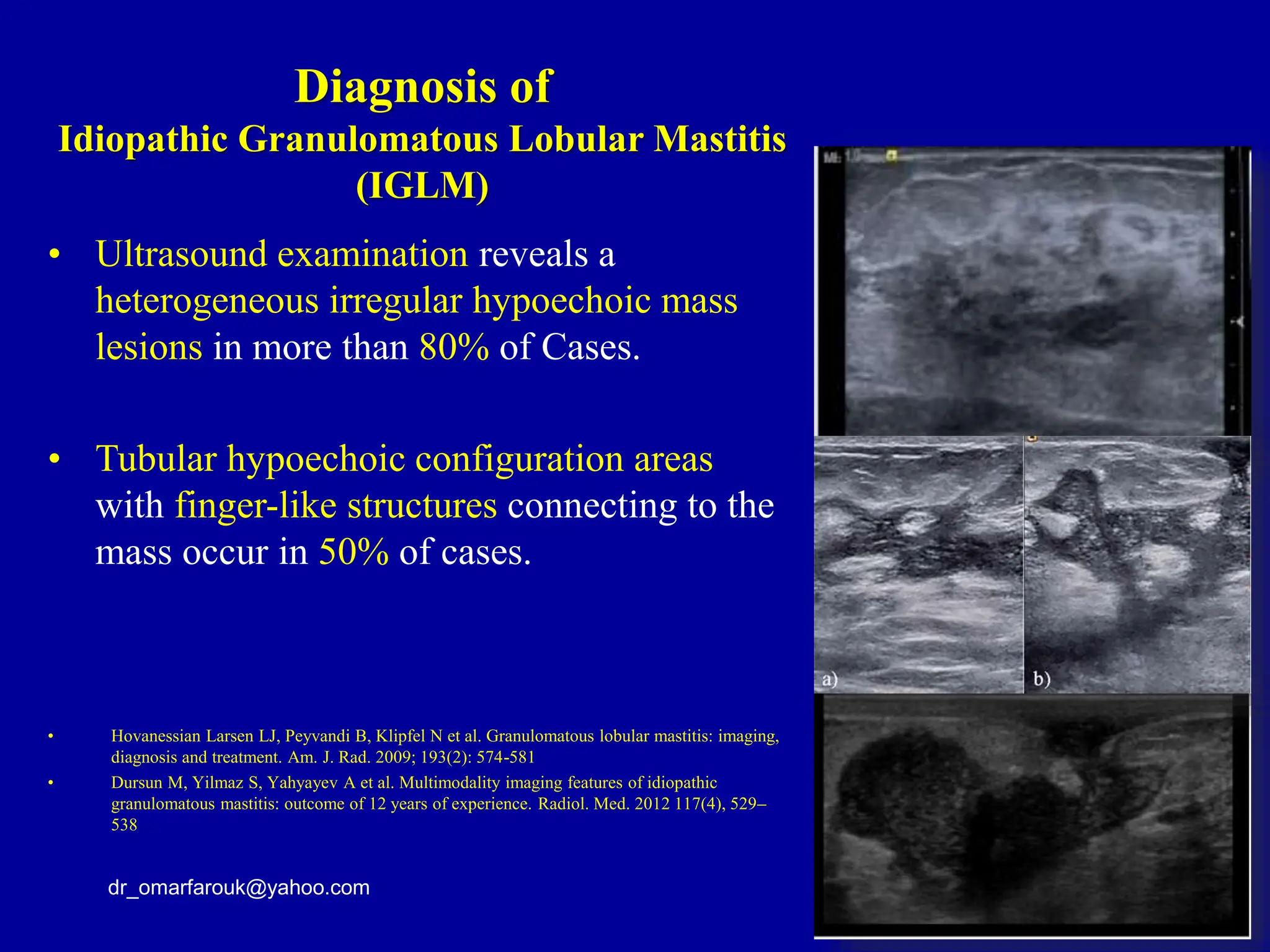 granulomatous mastitis the lect.ppt