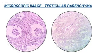 GRANULOMATOUS ORCHITIS .pptx