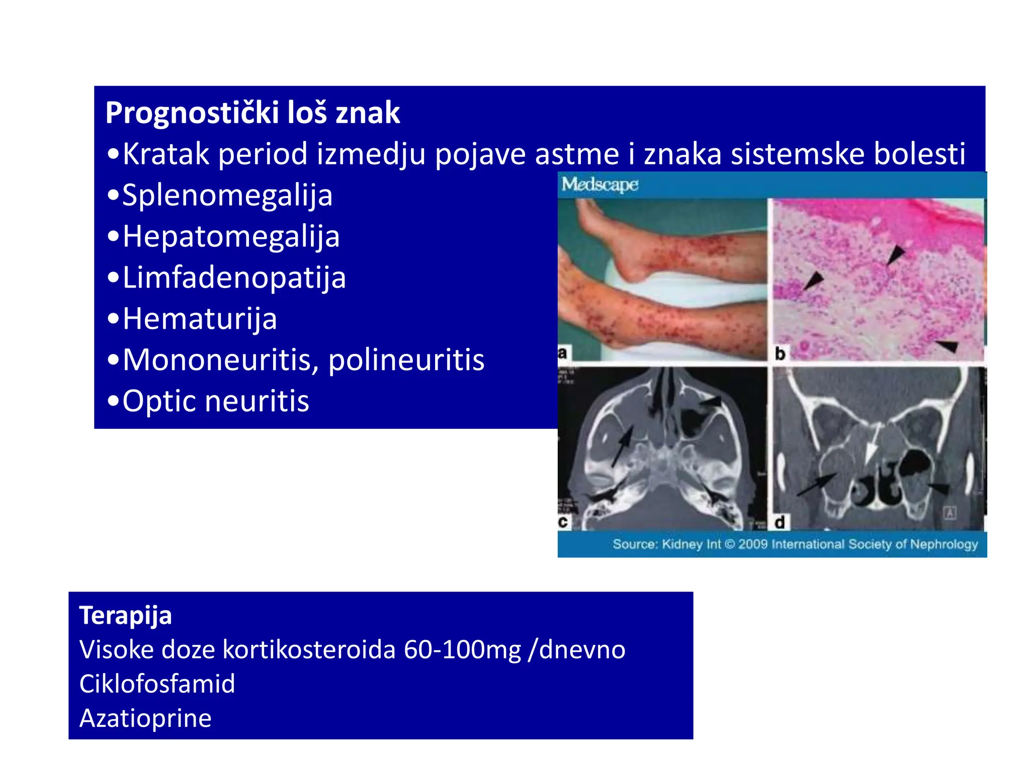 Granulomatosis presentation on powerpoint | PPT