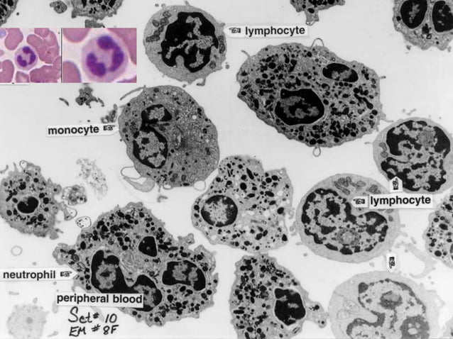 Granulocytes in health and disease | PPTX | Blood Disorders | Diseases ...