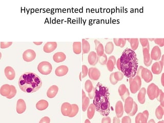 Granulocytes in health and disease | PPTX
