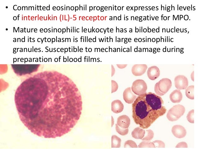 Immature Granulocytes High