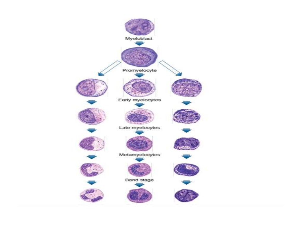 Immature Granulocytes High