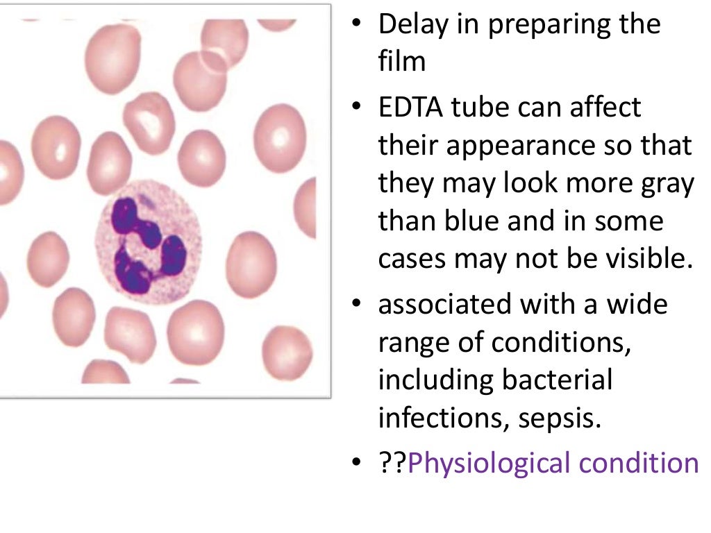 Granulocytes Types