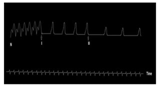 Amphibian Graphs and charts.pptx