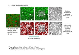 The Microstructure of Australian Cheddar Cheese and other Dairy ...