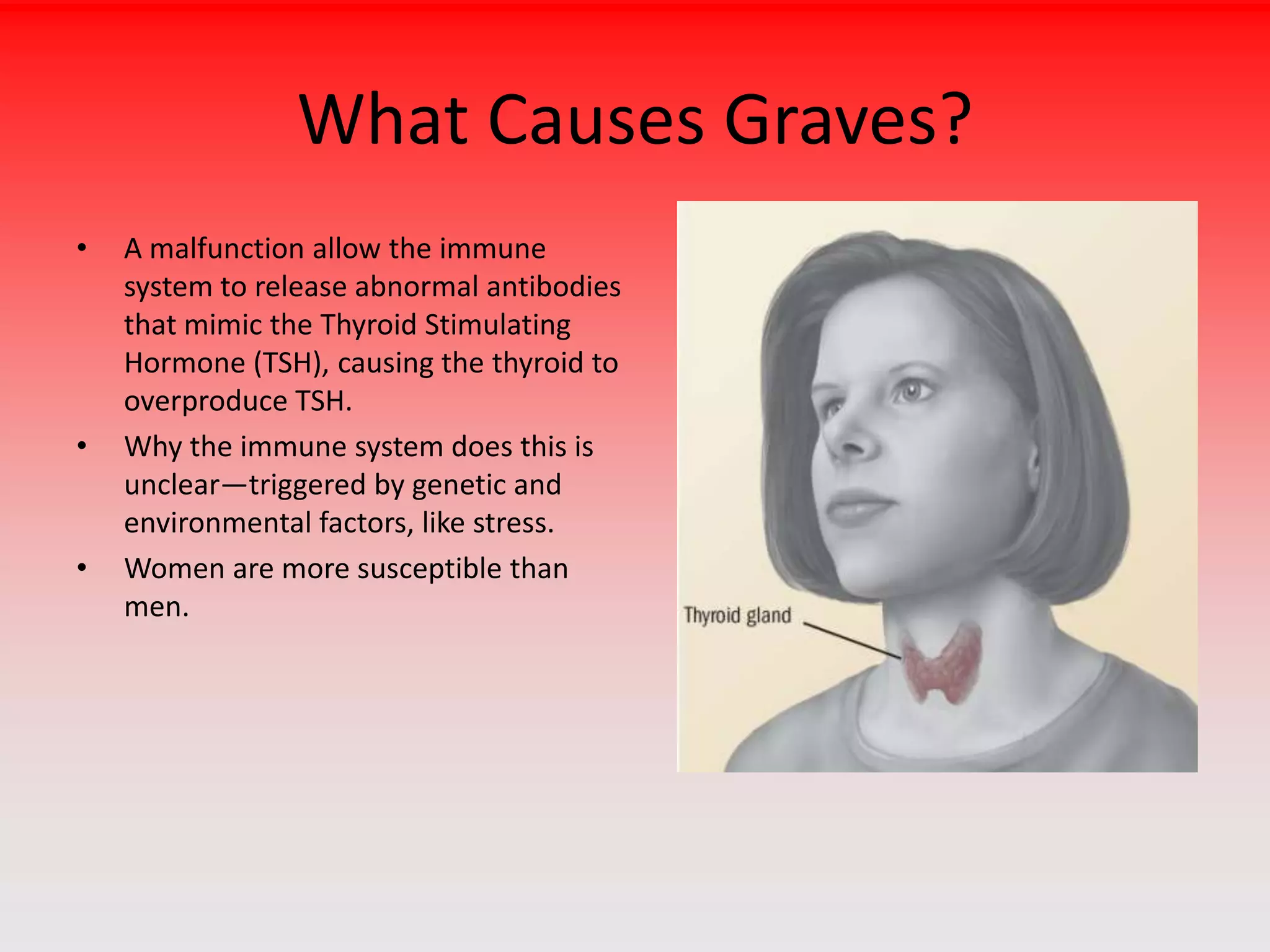 Graves Disease | PPTX