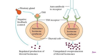 Pathophysiology of Graves disease | PDF