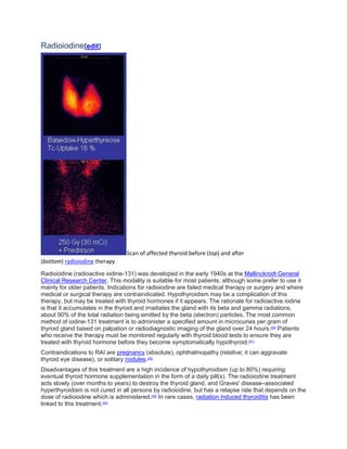 Wikipedia about Graves Disease internet. | DOCX