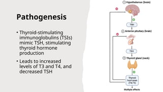 Graves' Disease Demonstrate understanding of basic concept ...
