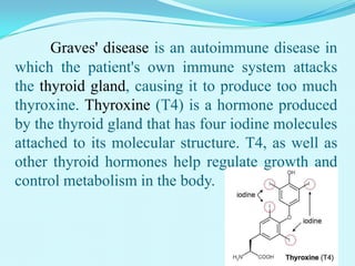 Graves’ disease (An autoimmune Disease) | PPTX