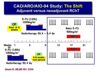 Gray areas in the management of colorectal cancer | PPTX