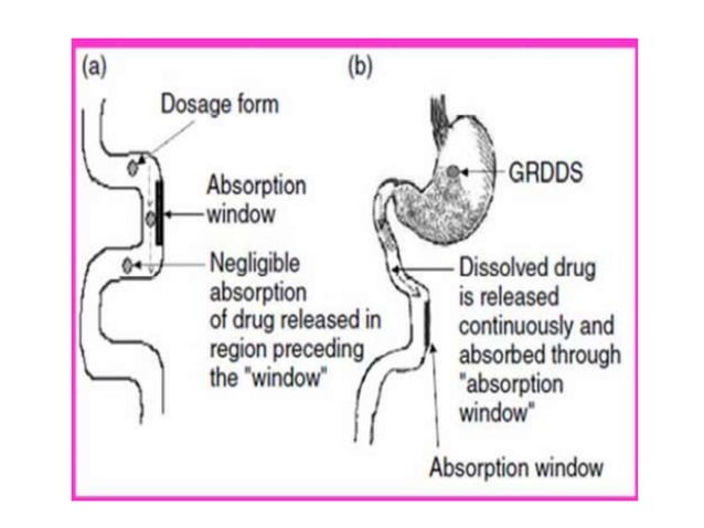 Gastro Retentive Drug Delivery System | PPTX