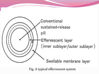 Gastroretentive Drug Delivery System | PPTX