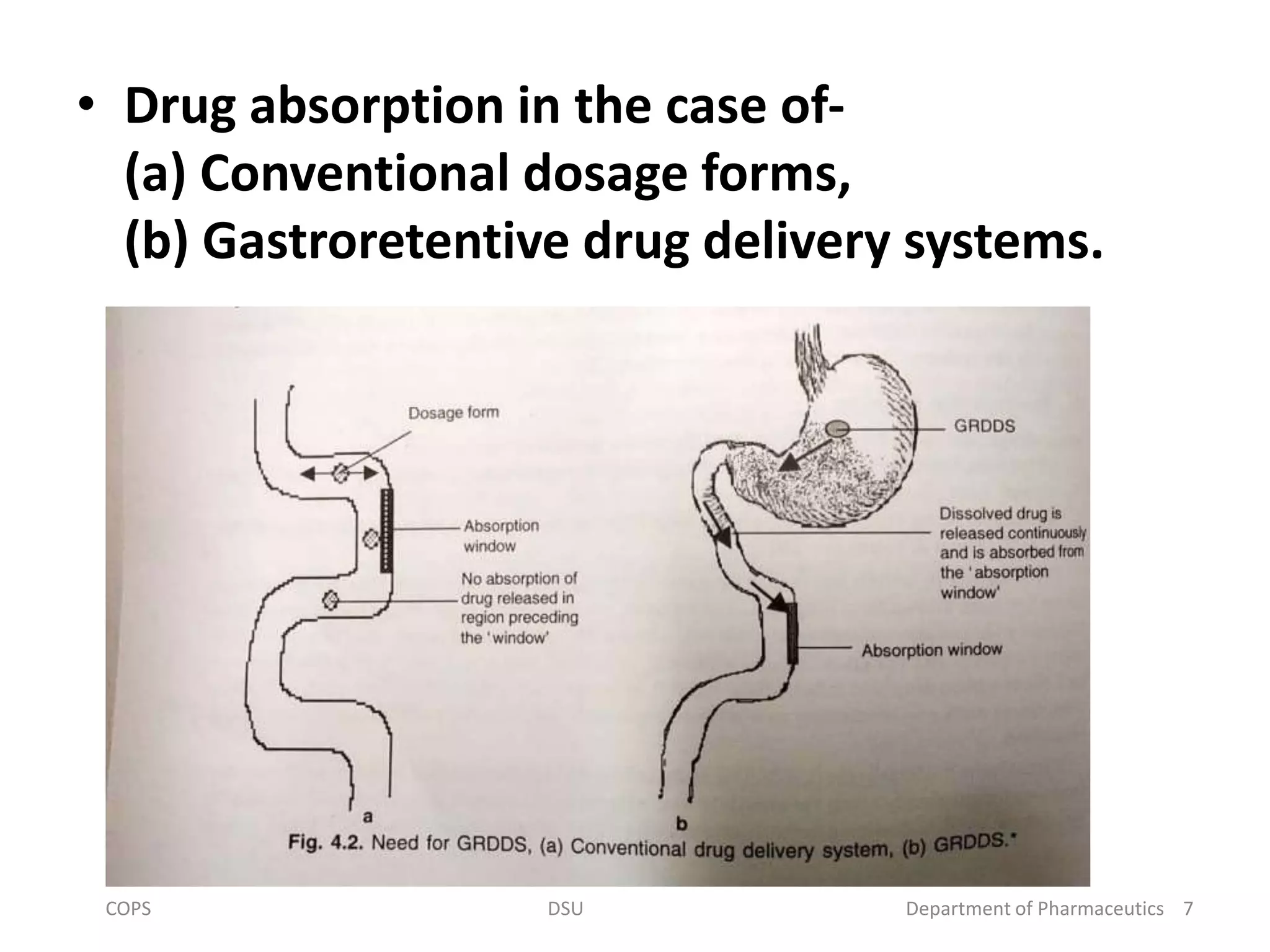 Gastroretentive drug delivery system | PPTX