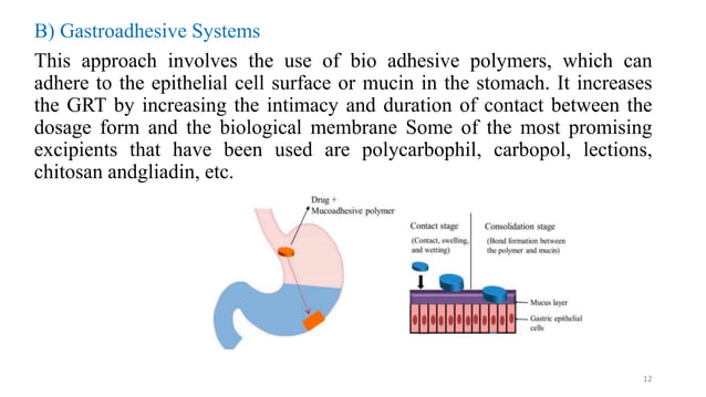 Gastroretentive drug delivery System | PPTX