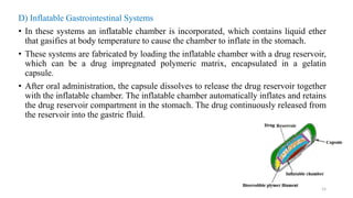 Gastroretentive drug delivery System | PPTX