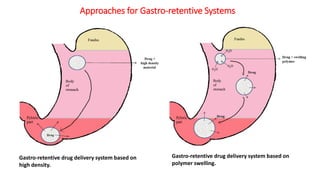 Gastroretentive Drug Delivery system | PDF | Digestive Disorders ...