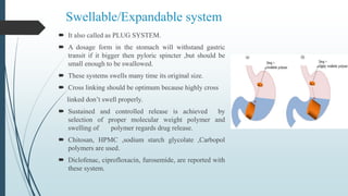 gastro retentive drug delivery system | PPTX