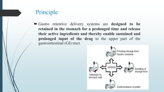 gastro retentive drug delivery system | PPTX
