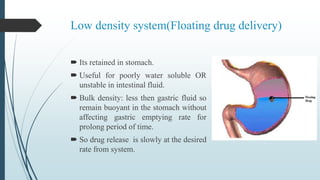 gastro retentive drug delivery system | PPTX