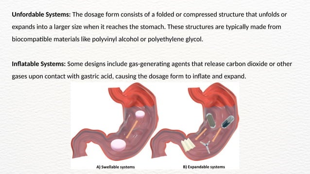 Gastro retentive drug delivery system (GRDDS) | PPTX | Digestive ...