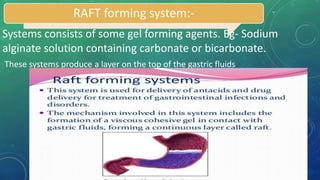 Gastro retentive drug delivery system | PPTX
