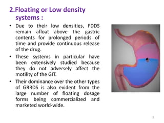 gastro rententive drug delivery | PPT