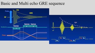 MRI Gradient Recalled Echo Pulse Sequence | PPTX