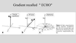 MRI Gradient Recalled Echo Pulse Sequence | PPTX
