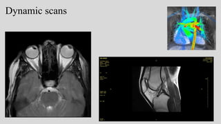 MRI Gradient Recalled Echo Pulse Sequence | PPTX