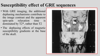 MRI Gradient Recalled Echo Pulse Sequence | PPTX