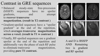 MRI Gradient Recalled Echo Pulse Sequence | PPTX