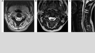MRI Gradient Recalled Echo Pulse Sequence | PPTX