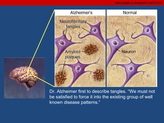 Types of Dementia, African Americans and Dementia | PPT