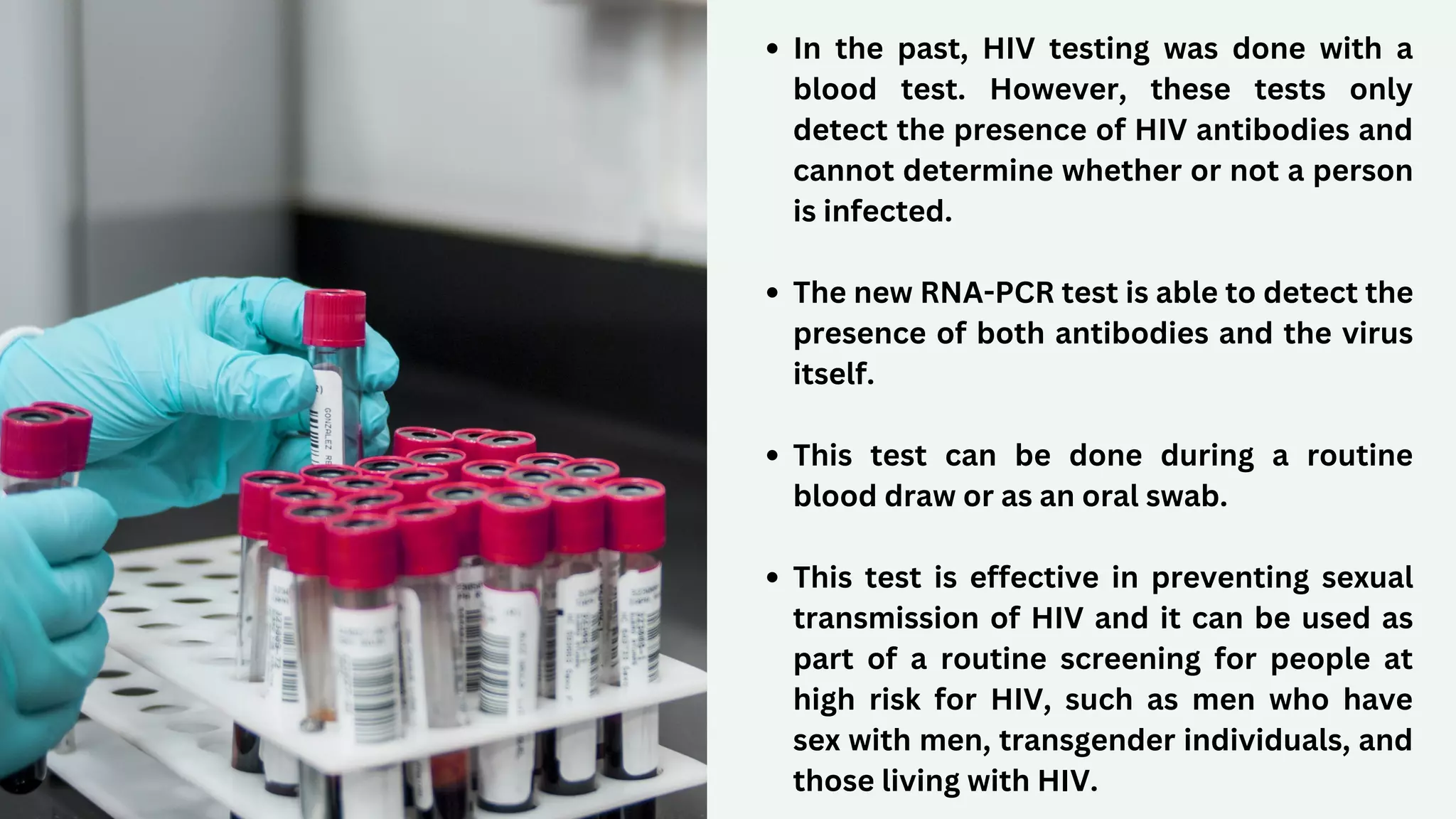 RNA PCR TEST FOR HIV | PDF