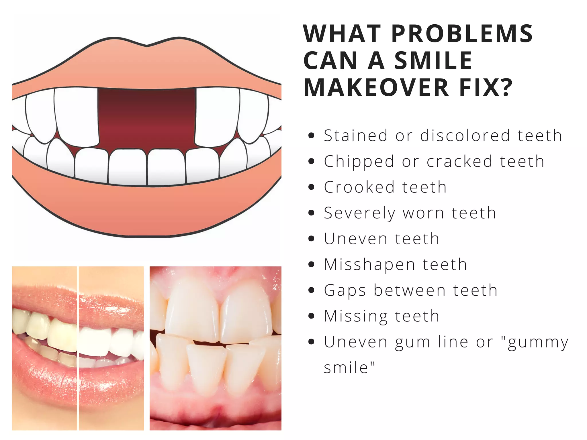 Smile Makeover: Your Guide to Achieving a Beautiful Smile | PPT