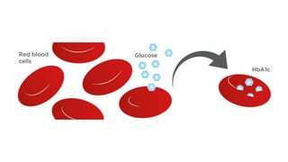 Diabetes - HbA1c | PPTX