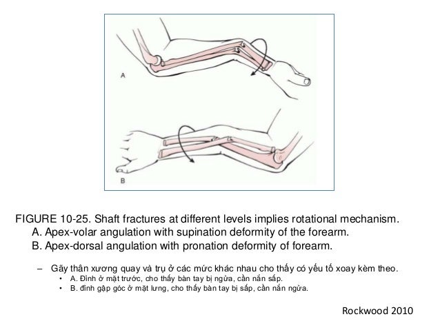 Greenstick fracture, gay canh tuoi
