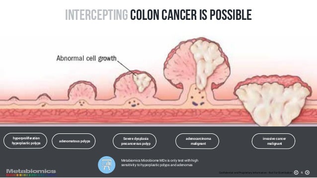 Microbiome Diagnostics Platform for Microbiome Health and Colon Cance…
