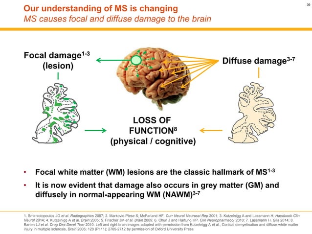 Grey matter and multiple sclerosis | PPT